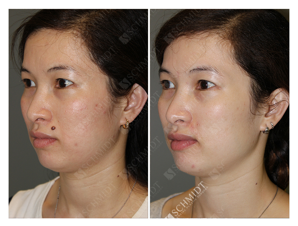 6322 - Schmidt Facial Plastic Surgery