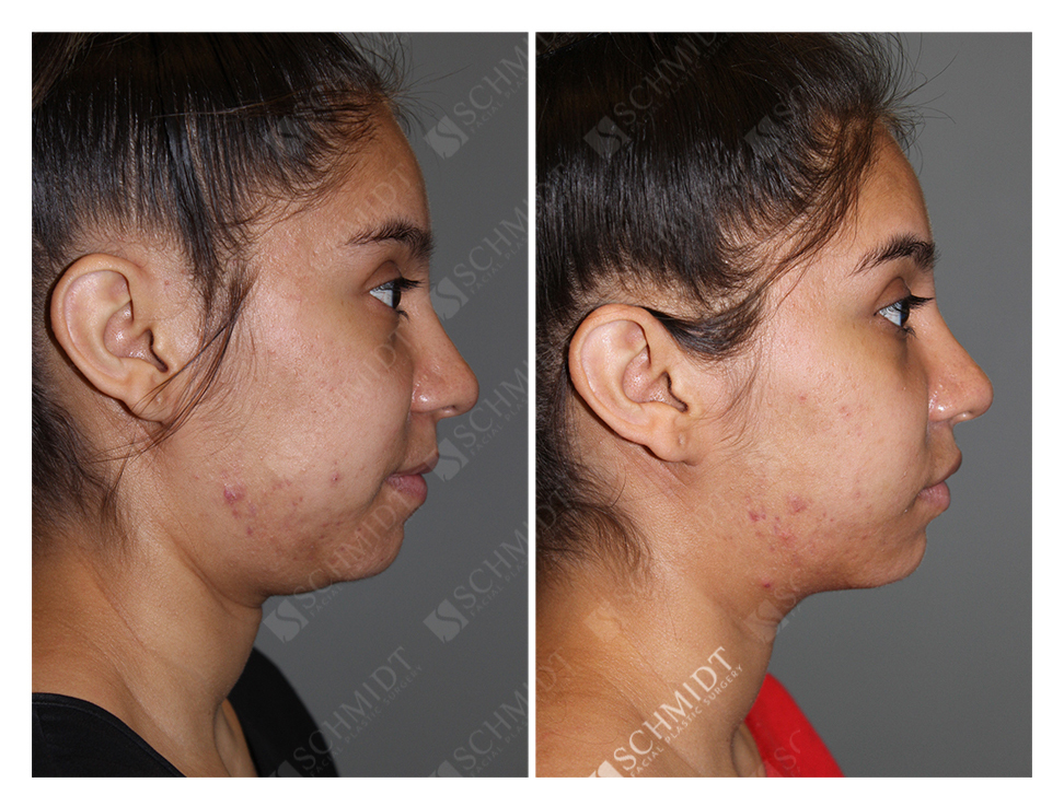 6552 - Schmidt Facial Plastic Surgery