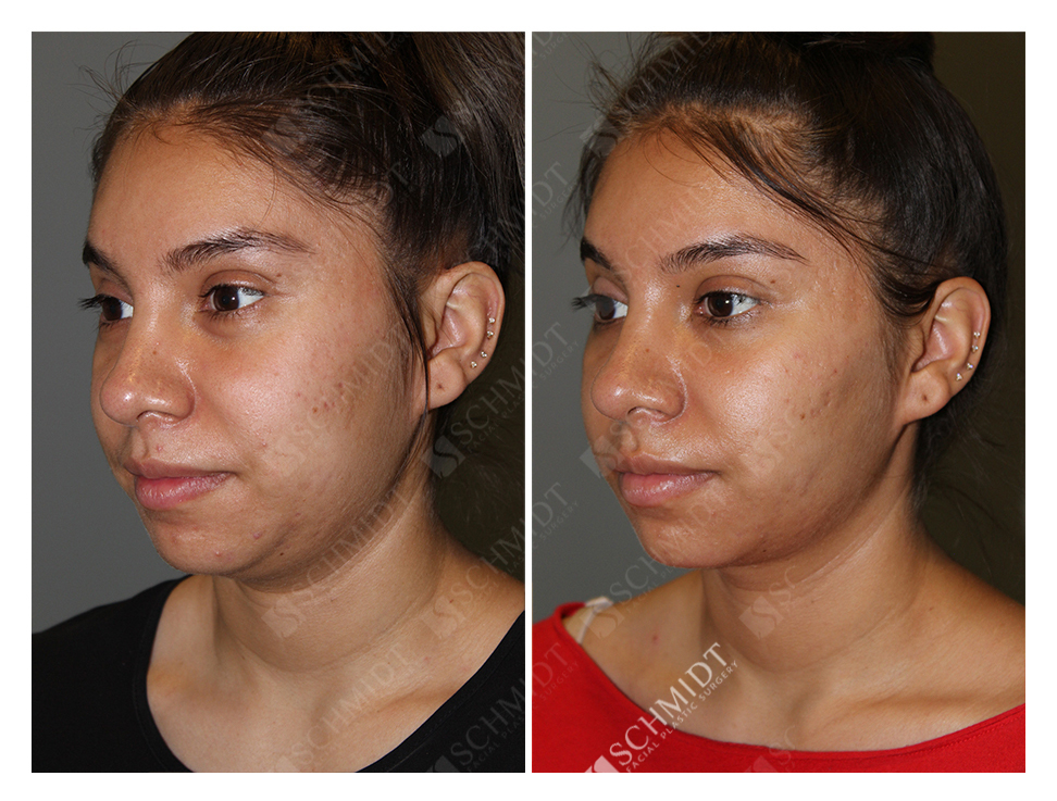 6552 - Schmidt Facial Plastic Surgery