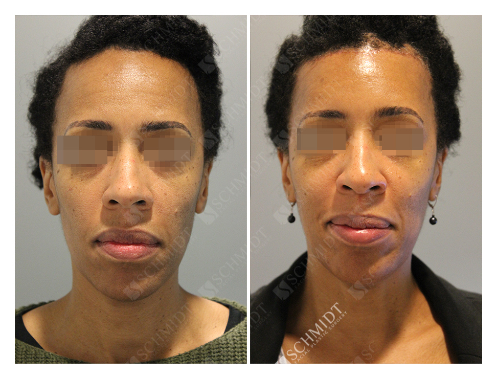 6589 - Schmidt Facial Plastic Surgery