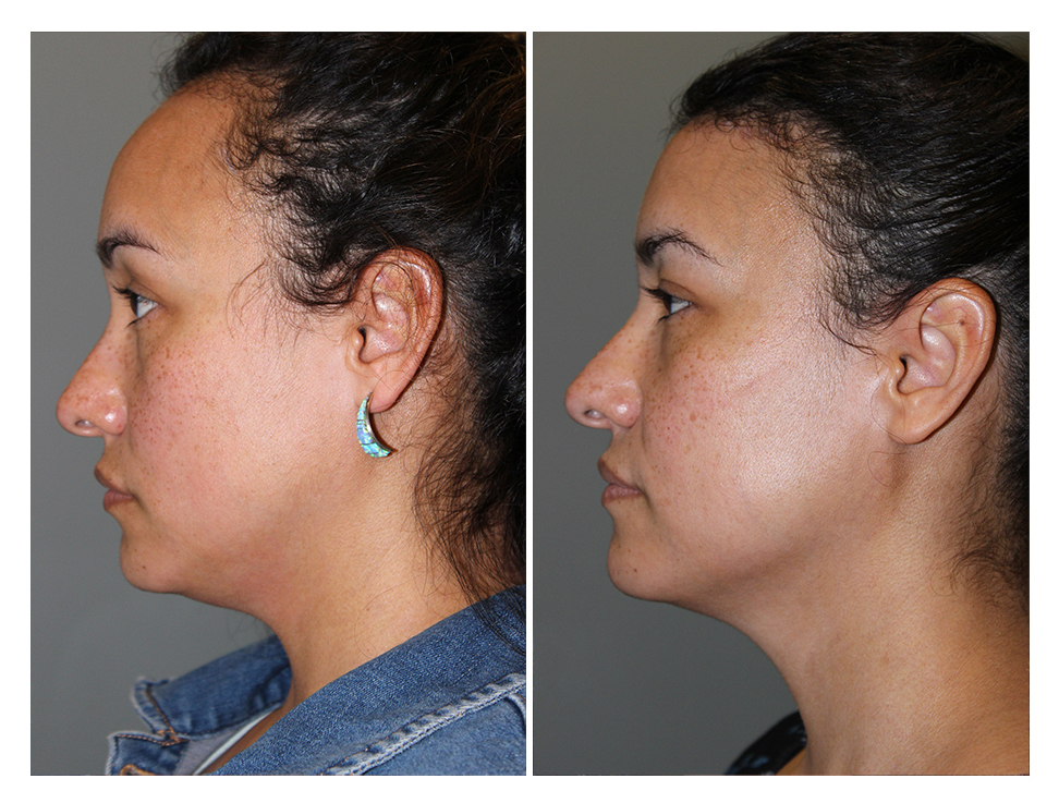 6616 - Schmidt Facial Plastic Surgery