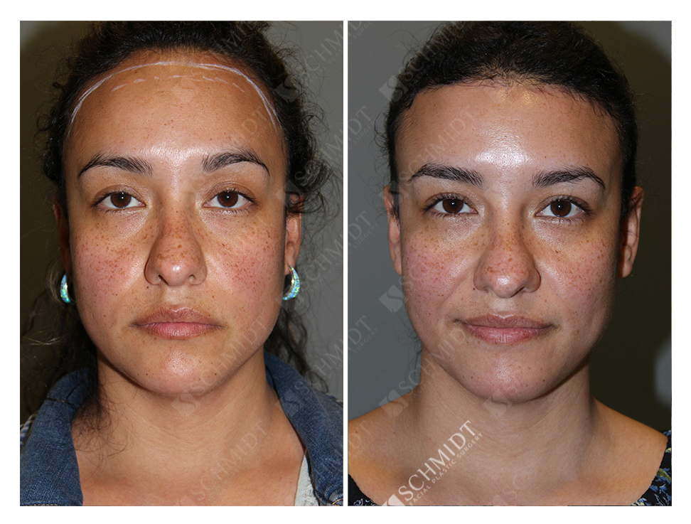 6616 - Schmidt Facial Plastic Surgery