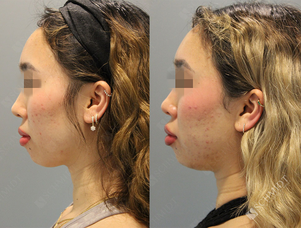 9022 - Schmidt Facial Plastic Surgery