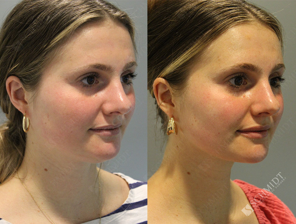 10322 - Schmidt Facial Plastic Surgery