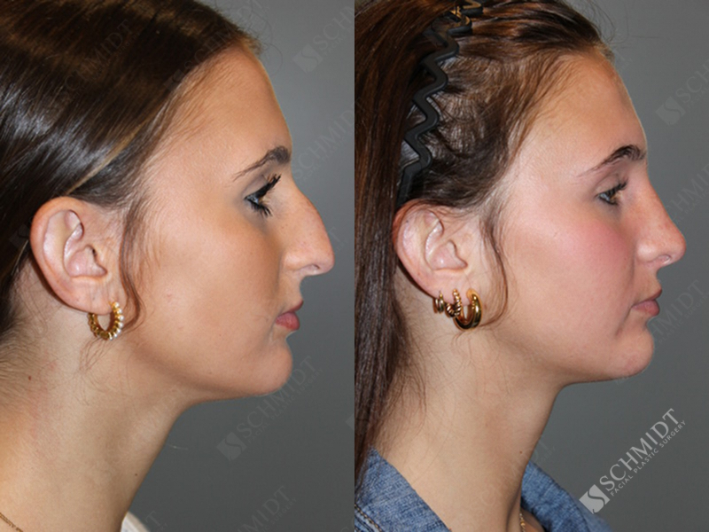 3576 - Schmidt Facial Plastic Surgery