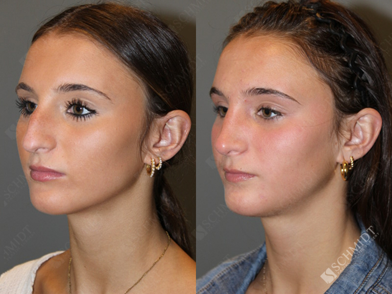 3576 - Schmidt Facial Plastic Surgery