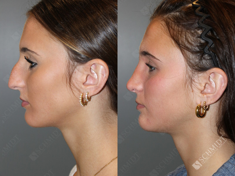 3576 - Schmidt Facial Plastic Surgery