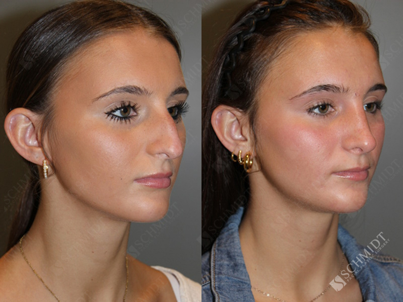 3576 - Schmidt Facial Plastic Surgery