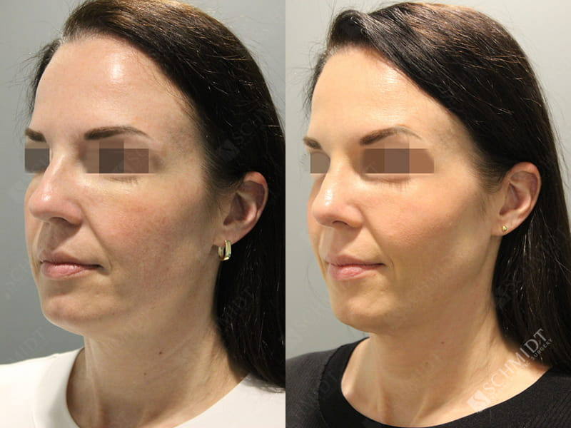 3561 - Schmidt Facial Plastic Surgery